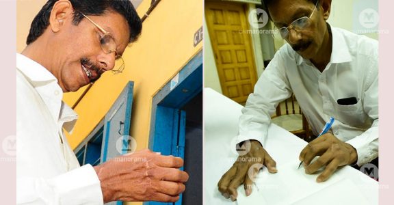 NIA's PFI raids: Kerala lecturer hand chop case from 2010 used as reference