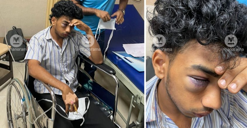 Ragging of see-student in Kozhikode: College suspends six students