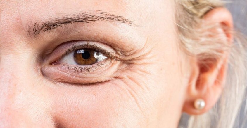 Know these factors that cause wrinkles, folds on your skin | Lifestyle ...