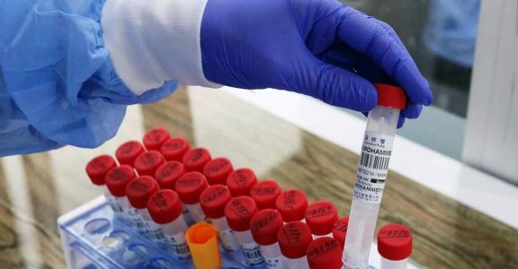 Why do some Covid tests give false positive results? | Lifestyle Health ...