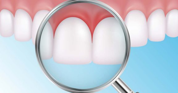 Take these simple steps to keep your gums healthy | Lifestyle Health ...