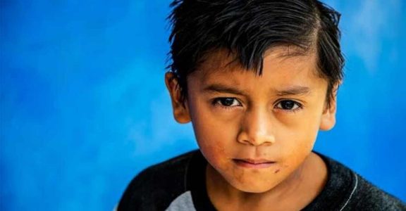 One-third of under-5 children in India chronically undernourished ...